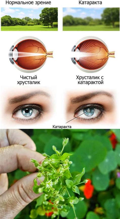 Домашний Целебник | Трава, Траволечение, Товары для здоровья