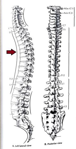 Netters Spine Cage Flashcards Quizlet