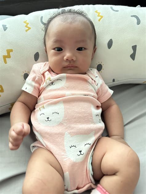 High Nt With Negative Nipt R Nipt