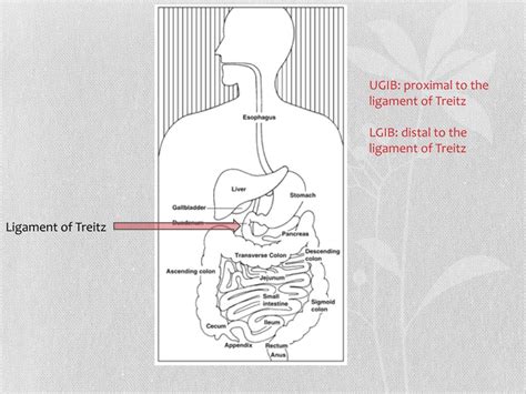 Ppt Gi Bleeding Powerpoint Presentation Free Download Id1796768