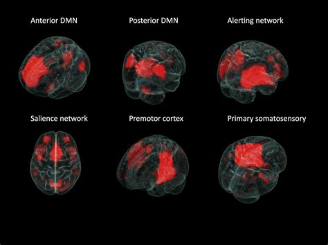 Brain Mapping [image] Eurekalert Science News Releases