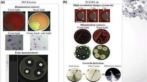 Automation In Microbiology Pptx Chemistry Science