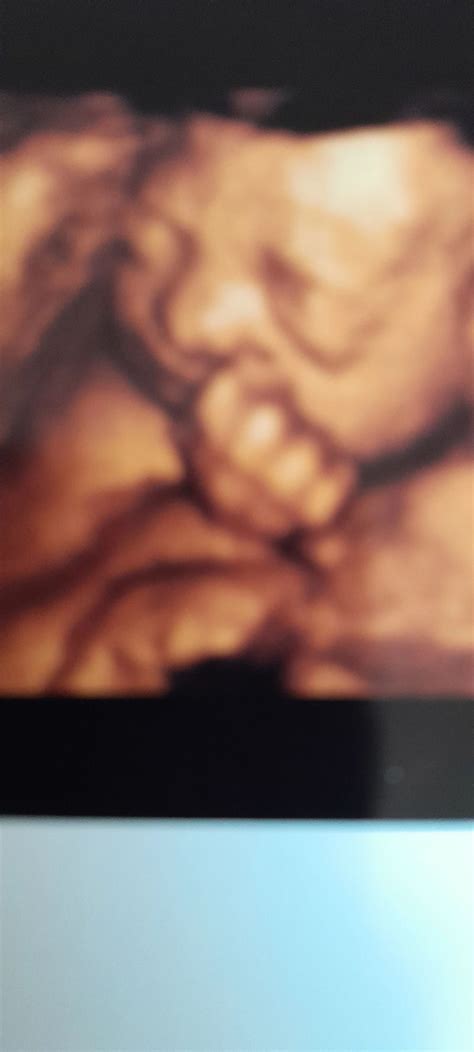 Hichem Attaoui Posted On Linkedin