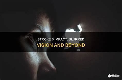 Strokes Impact Blurred Vision And Beyond Medshun