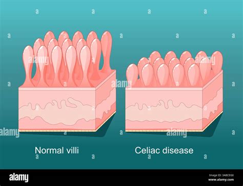 This Image Shows A Cross Section Of The Small Intestine Revealing