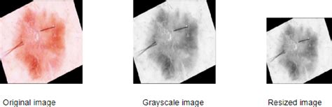 Figure From Method To Classify Skin Lesions Using Dermoscopic Images Semantic Scholar