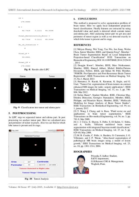 Brain Tumour Segmentation Based On Local Independent Projection Based…