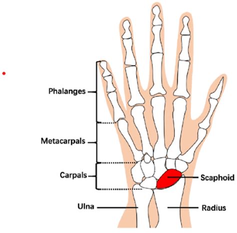 Scaphoid Fracture Detection By Using Convolutional Neural Network