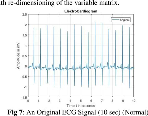Figure 7 From Classification Of Arrhythmia From Ecg Signals Using Matlab Semantic Scholar