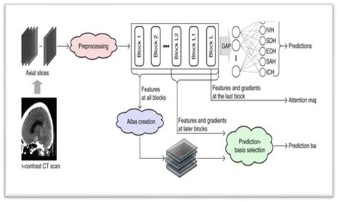 Deep Learning In Action For Classifying Ct Scan Images Which Outputs A Download Scientific