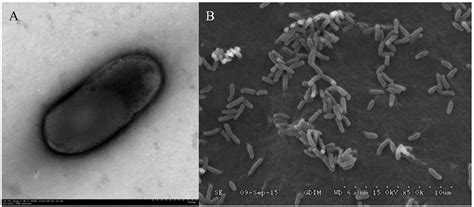 Facultatively Autotrophic Sulfur Oxidation Denitrification Rhizobium