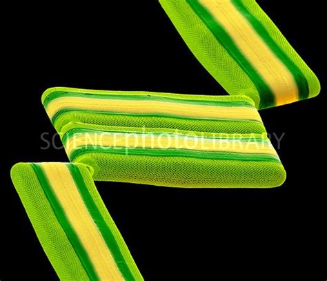 Coloured Scanning Electron Micrograph Of Tabellaria Diatoms