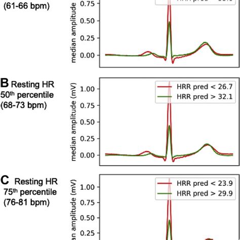 Representations Of Deep Learning Electrocardiogram Ecg Model Download Scientific Diagram