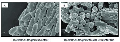 Mode Of Action Of Enterocin Kae 01 Using Sem P Aeruginosa A Control