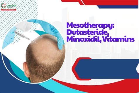 Kỹ Thuật Tiêm Mesotherapy Thuốc Dutasteride Minoxidil Vitamins Trong