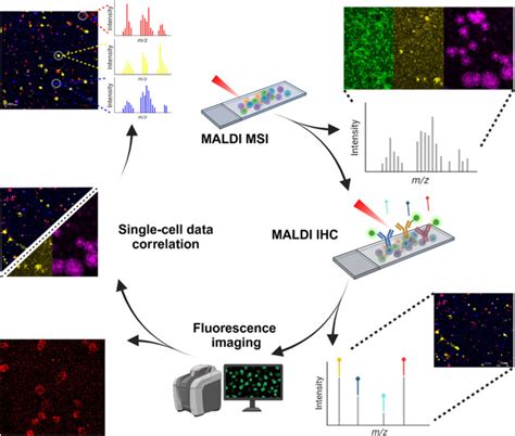 Molecular Profiling Of Glioblastoma Patient Derived Single Cells Using Combined Maldi Msi And