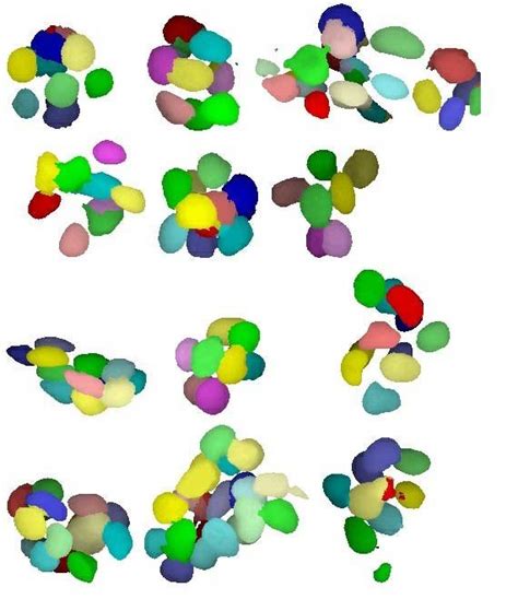 Segmentation Results On A Number Of Cultured Colonies Download