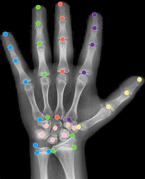 thirty seven keypoints detected using scn networks scn spatial