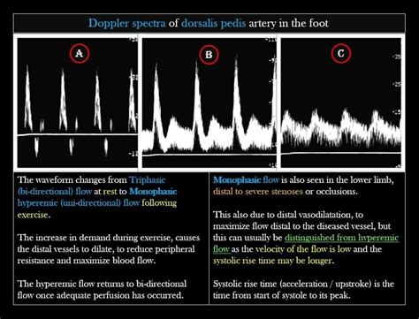 Pin By Mourad Salama On Sonography Vascular Ultrasound Medical