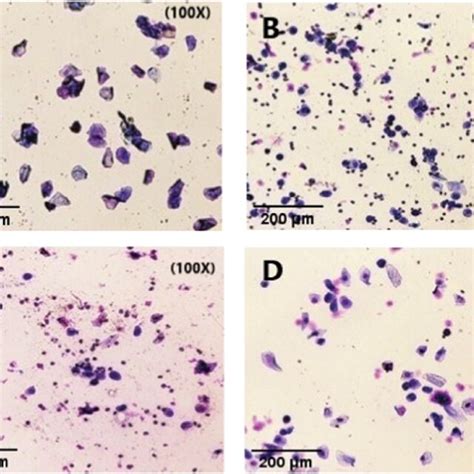 Estrous Cycle Phase In Rats A Estrous Phase Shows A Large Number Of