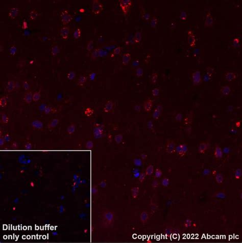 alexa fluor® 555 anti lc3b autophagosome marker 抗体 [epr18709] ab307768