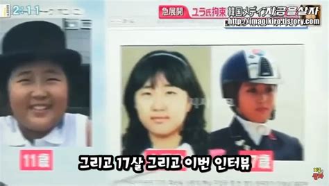 일본에서 한국인들 성형 많이한다고 낙인찍힘  인스티즈 Instiz 이슈 카테고리