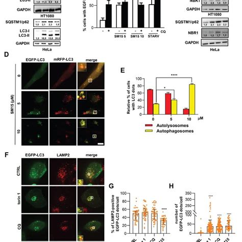 Confocal Imaging Of Mcherry Gfp Lc3 Vesicles Mcherry Wdfy Vesicles Download Scientific