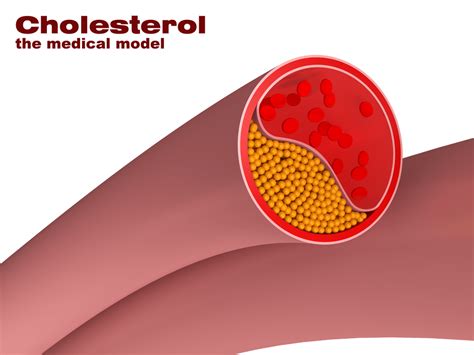Low Hdl Cholesterol Does Not Cause Heart Attacks