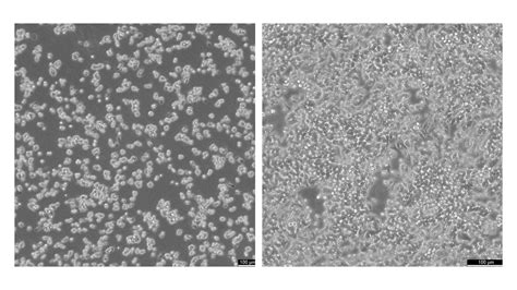 RAW 264.7 Zelllinie in der Makrophagen- und Immunologieforschung