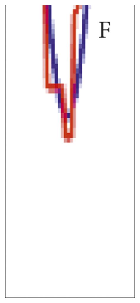 Curve Comparison Between The Original Signal Xt And The Denoised Signal