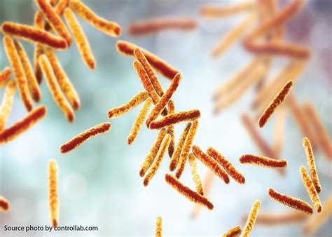 Rapid And Spesific Detection Of Mycobacterium Tuberculosis Using Polymerase Chain Reaction