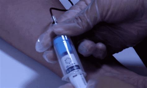 Prp Preparation Procedure Prp Kit Prp Tube Platelet Rich Plasma