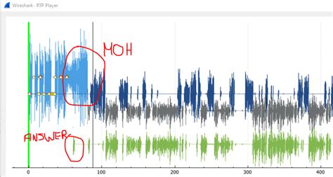 RTP Audio Issue Endpoints FreePBX Community Forums