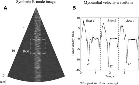 Example Of Synthetic Image And Velocity Waveforms A B Mode Sector Download Scientific