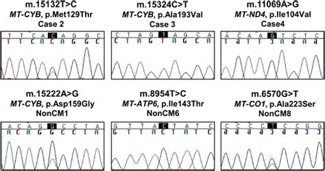 Six Novel Non Haplogroup Variants As Potential Pathogenic Mtdna