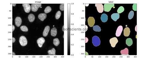 stardist cell detection with star convex polygons softscients