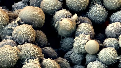 70 Cancer Cell Sem Stock Videos Footage And 4k Video Clips Getty Images