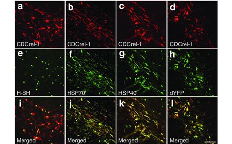 Double Immunohistochemical Labeling To Show Colocalization Of Download Scientific Diagram