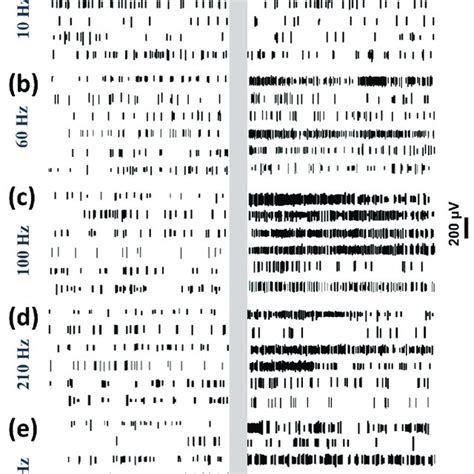 The Neural Spike Firing Variations During Deep Brain Stimulation Dbs Download Scientific