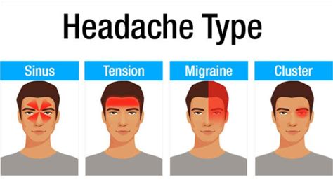 Types Of Headaches Which One Do You Have Types Of Headaches My XXX Hot Girl