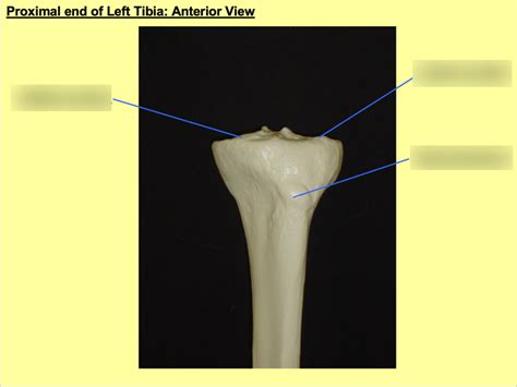 Proximal End Of Left Tibia Anterior Diagram Quizlet
