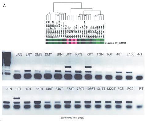 Semiquantitative Reverse Transcriptase Polymerase Chain Reaction