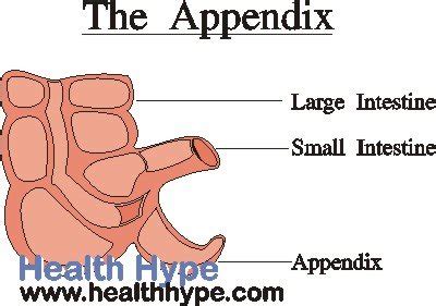 Abscess In The Appendix Symptoms Diagnosis And Treatment Healthhype