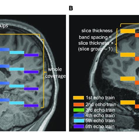 Spatial And Temporal Snr Of The Super Resolution Reconstructed Images Download Scientific