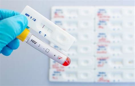 Your Health Matters Choosing The Right Std Test Kit At Home