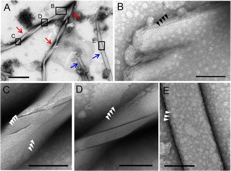 Negative Staining Electron Micrographs Of Aqueous Dispersion Of Milk