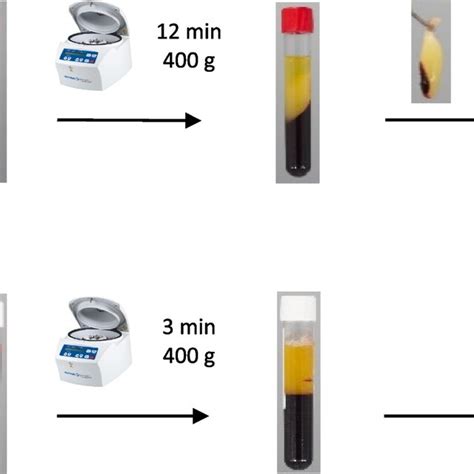 Leukocyte And Platelet Rich Fibrin L Prf Preparation Protocol Top Download Scientific