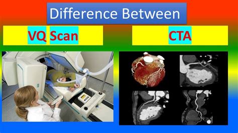 Difference Between VQ Scan And CTA Scan YouTube