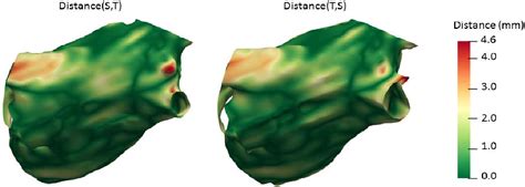 Figure 3 From Reproducibility And Accuracy Of Lge Cmr Measurements Related To Detection Of Left