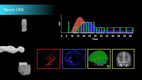 Advanced Interventional Software 4d Ct Angiography Interventional Radiology Canon